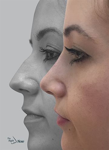 Gallery - about us - The Right Nose