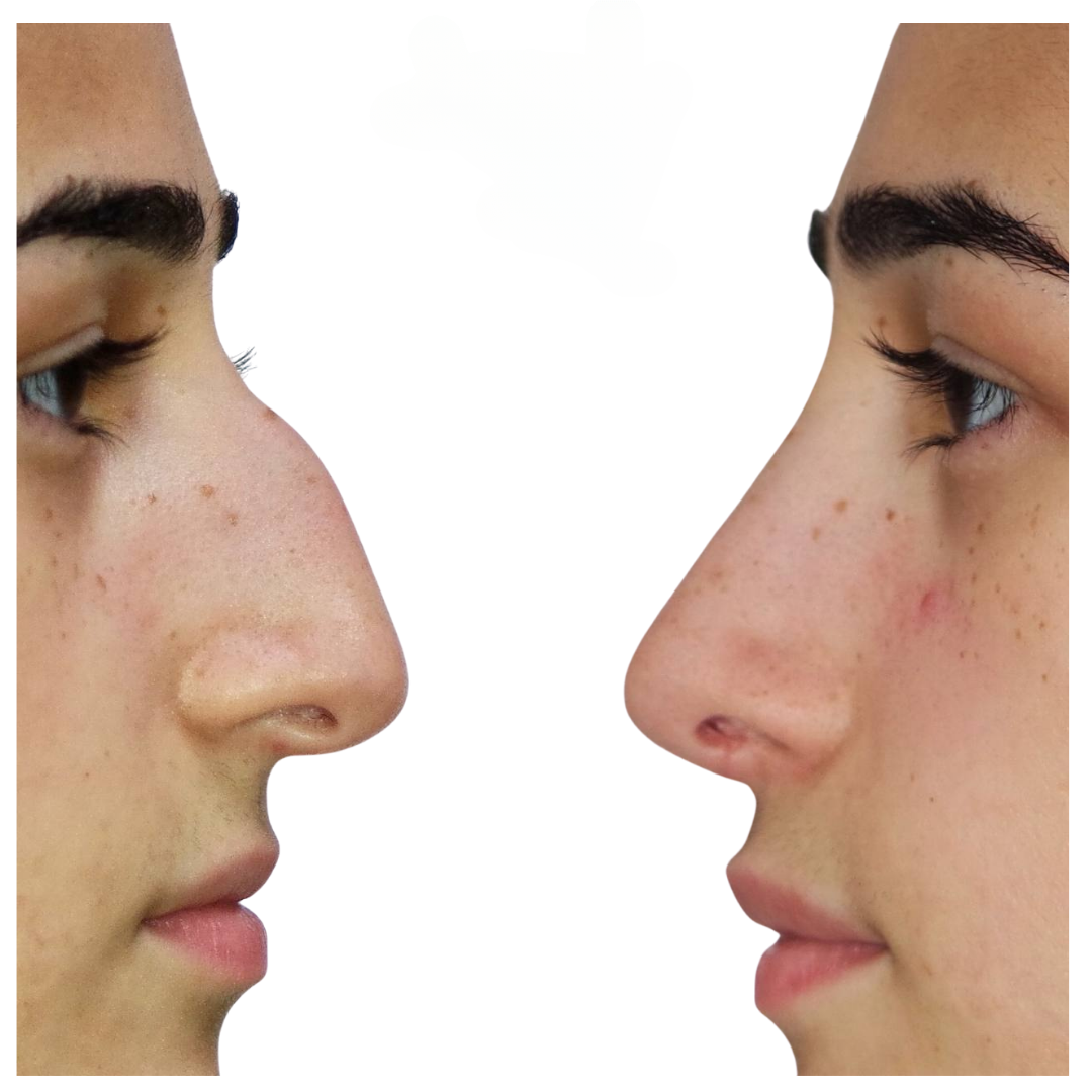 Gallery - about us - The Right Nose