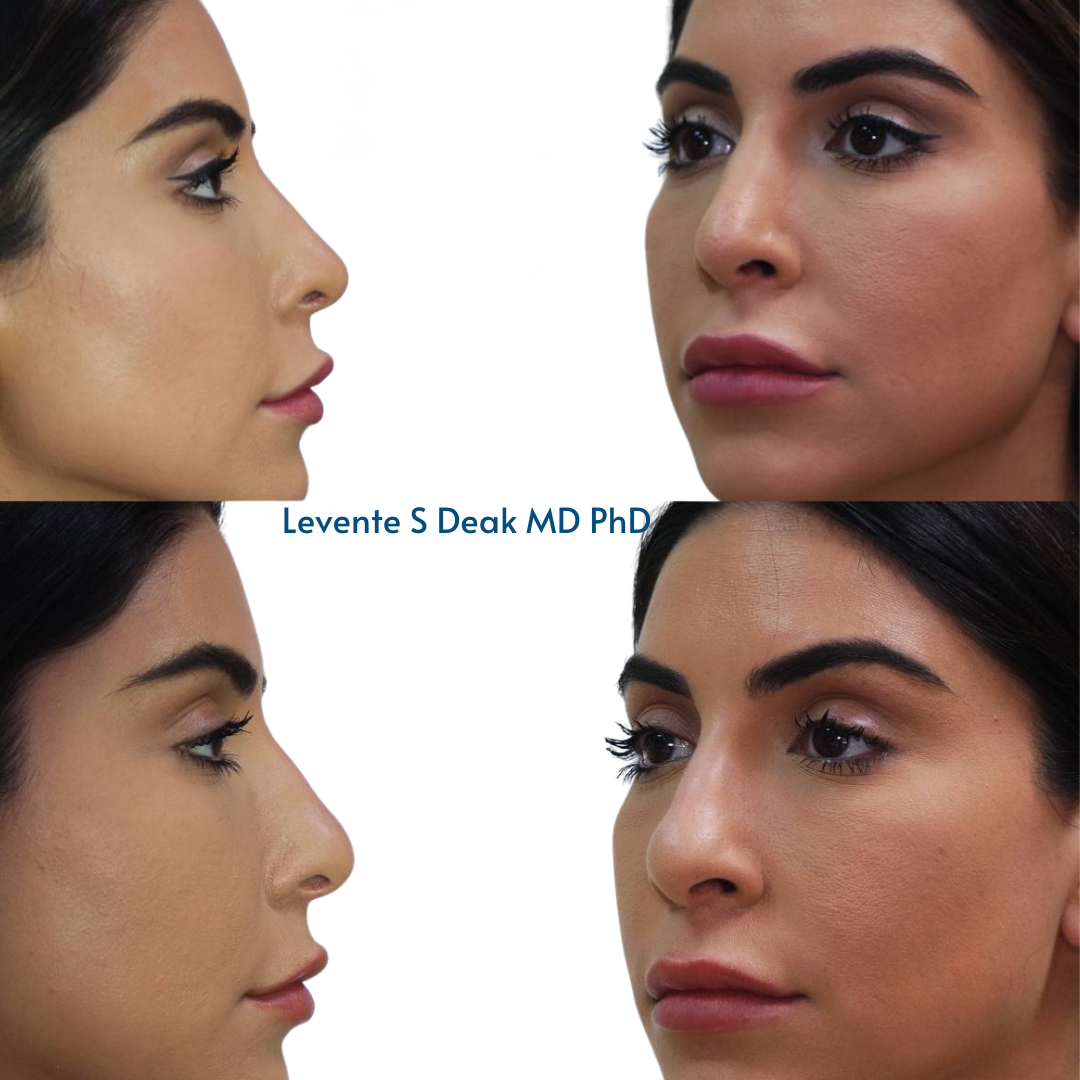 Gallery - about us - The Right Nose